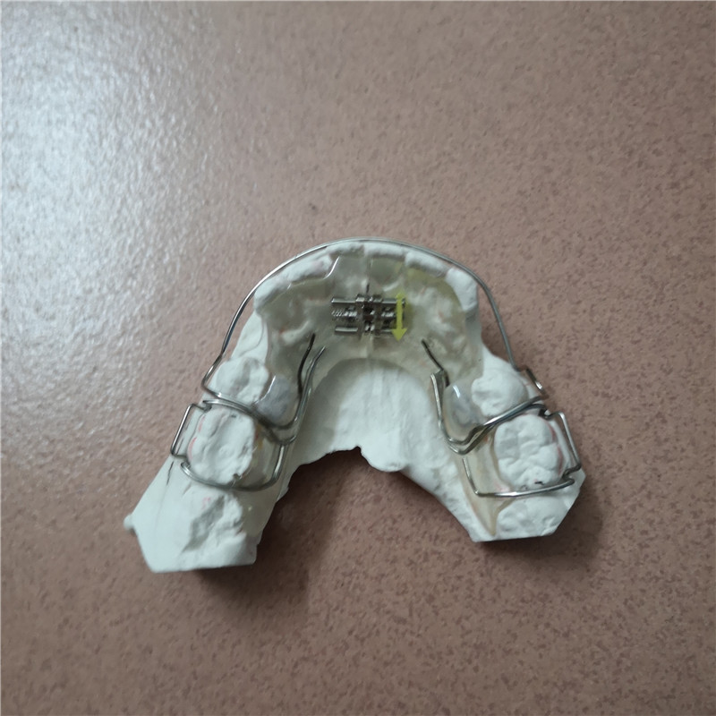 Orthodontics and others – Shenzhen Well Dental Laboratory