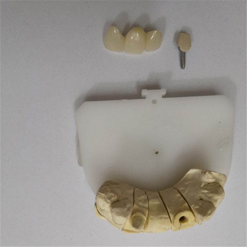 Full Cast – Shenzhen Well Dental Laboratory